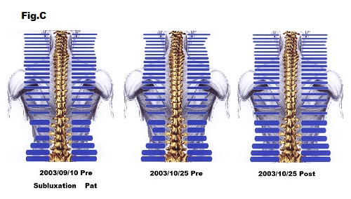 So What does a Specific Upper Cervical Chiropractor examine? | Please ...